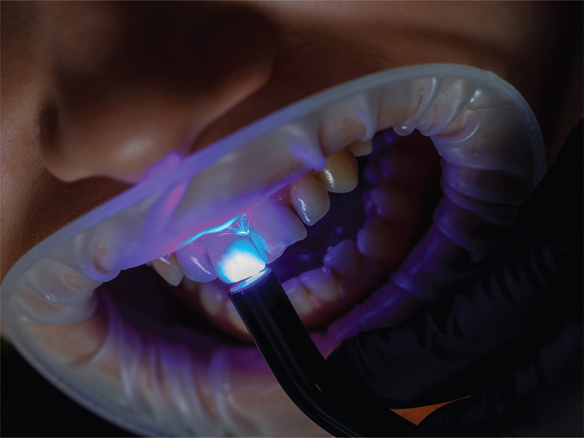 DSC-UV เครื่องมือวิเคราะห์สมบัติระบบการบ่มหรืออบด้วยแสงยูวี | kinetics ...